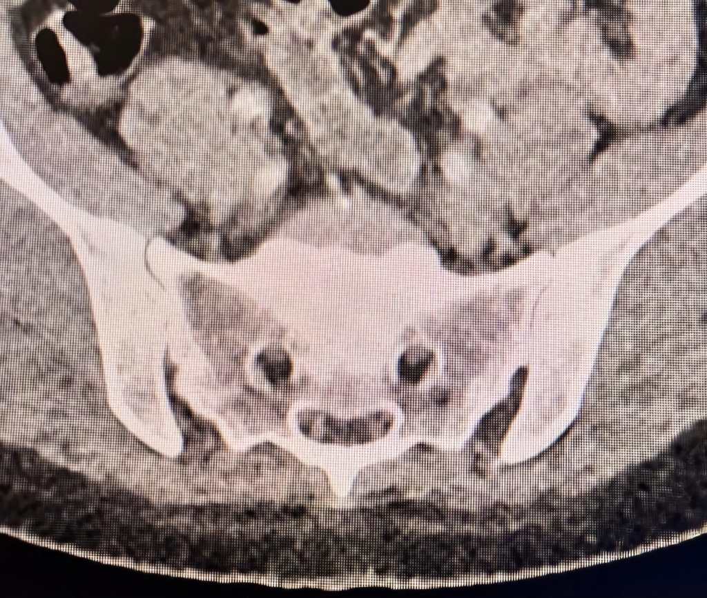 Is That MRI Scan Really Necessary? It Might Be Slowing You Down